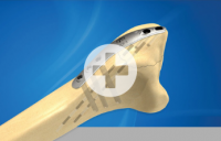 TriMed Inc. – Medical Devices